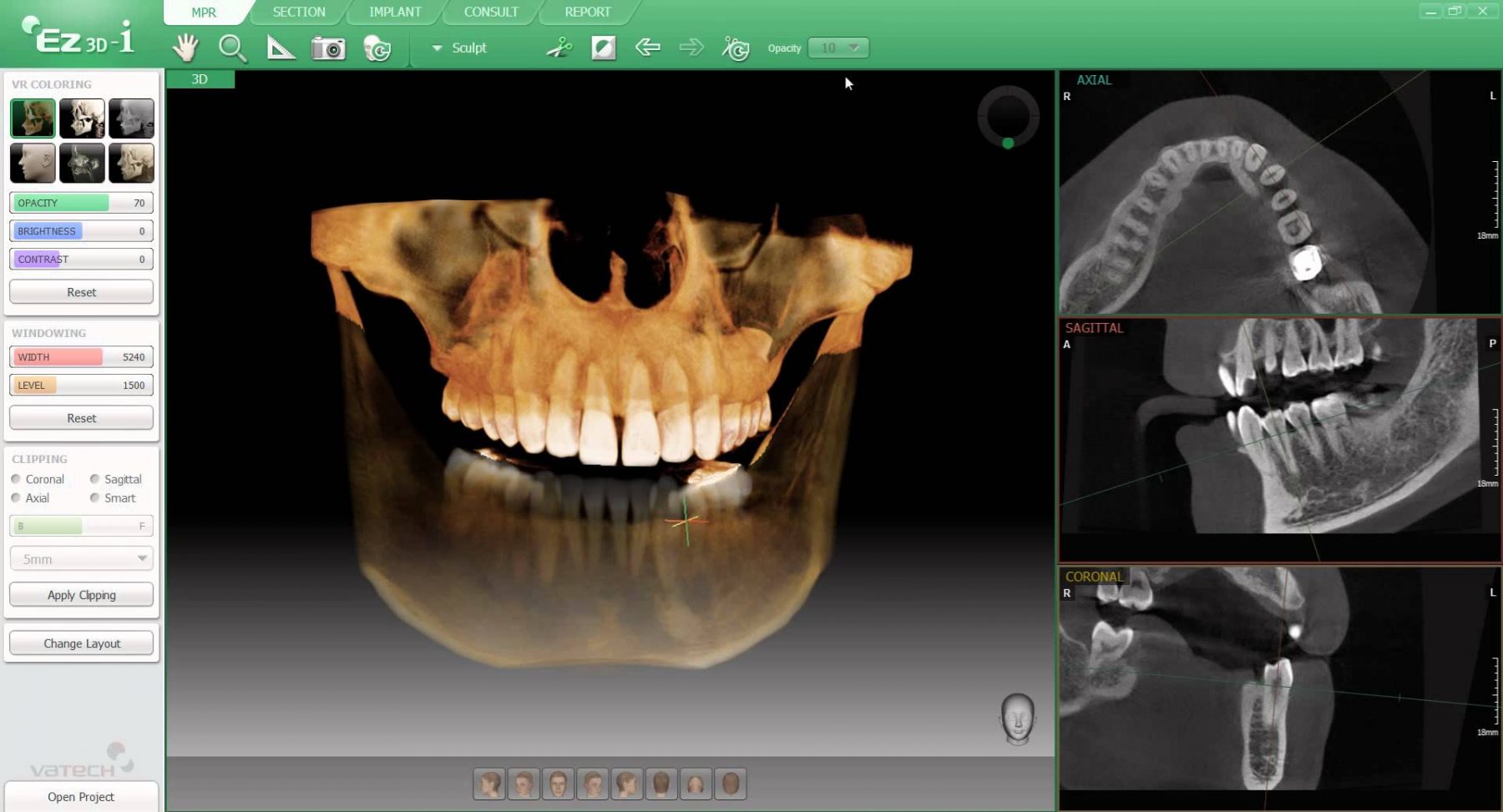 Cone Beam CT Imaging (3D Xray) - Uptown Dental Surgery